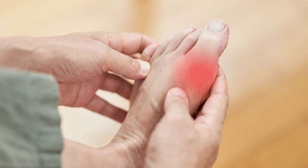 What Is Hyperuricemia? Causes and Control
