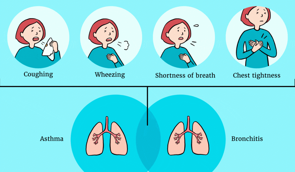 Respirar con facilidad: comprender y reconocer los síntomas comunes del ...